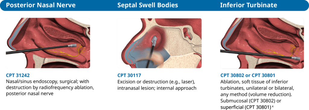 CHRONIC RHINITIS REQUIRES COMPREHENSIVE TREATMENT